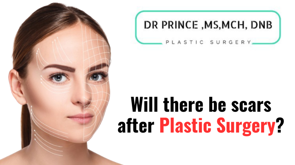 Will There Be Scars After Plastic Surgery Topplasticsurgery