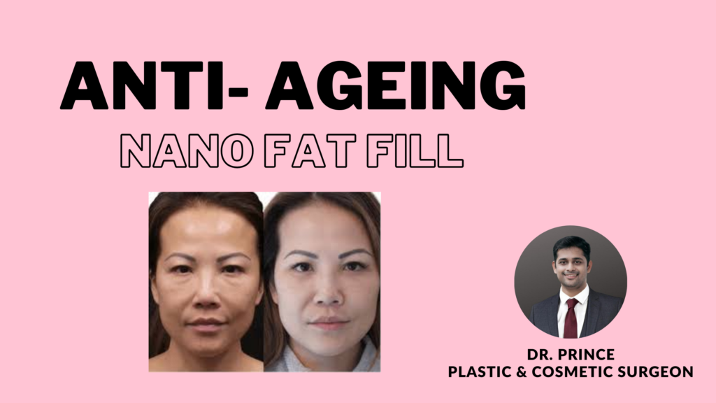 Reversing Time: The Art and Science of Anti-Aging Nano Fat Fill ...