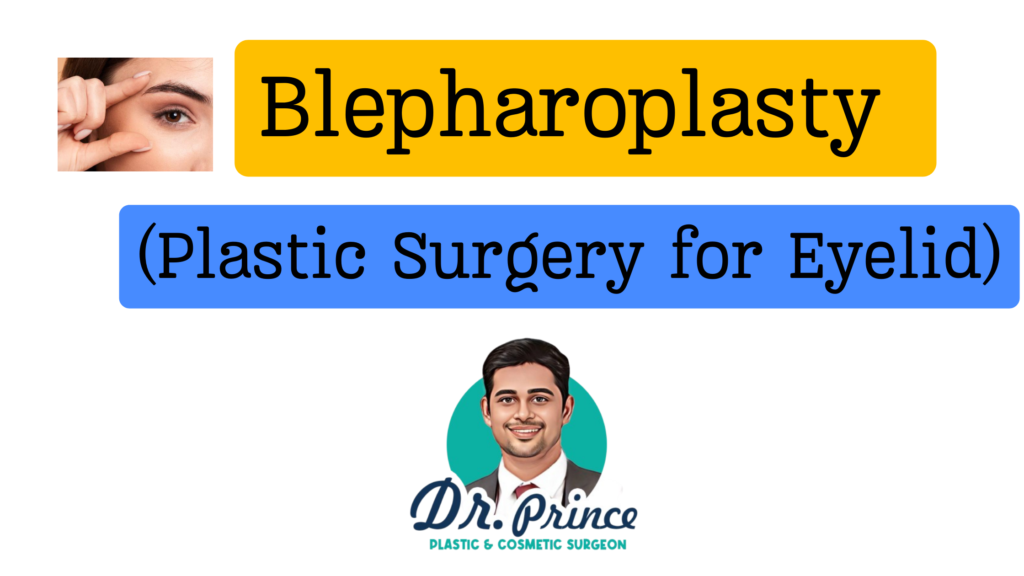 The Art of Rejuvenation: Understanding Blepharoplasty with Dr. Prince - topplasticsurgery