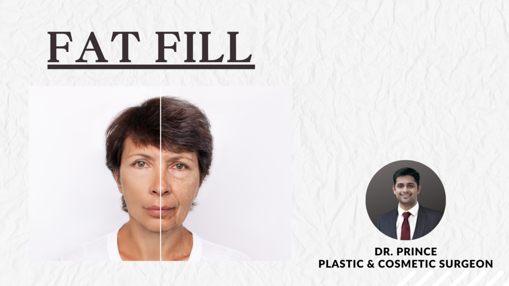 Sculpting Beauty: A Comprehensive Guide to Fat Fill Procedures by Dr ...