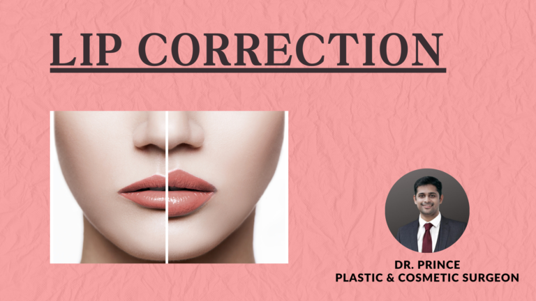 Perfecting Symmetry: A Comprehensive Guide to Lip Correction by Dr ...