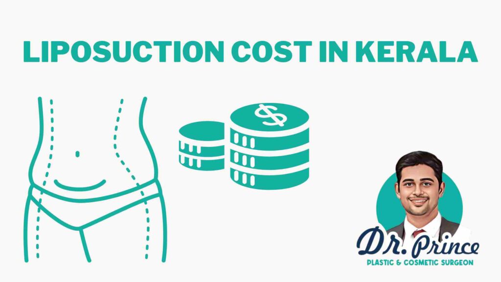 Liposuction cost in Kerala - topplasticsurgery