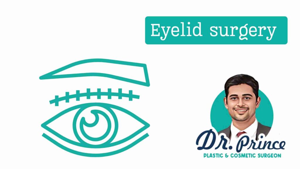 Eyelid Surgery in Kerala - topplasticsurgery