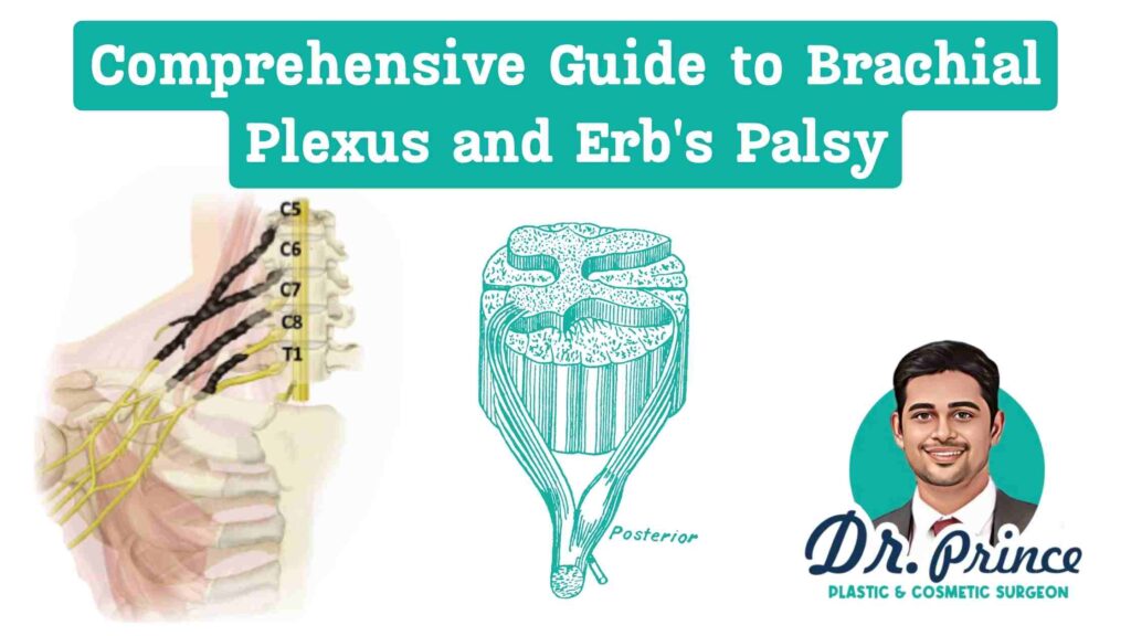 Brachial Plexus - topplasticsurgery