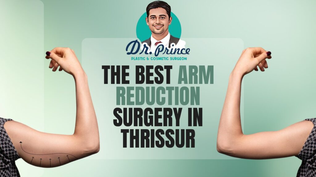 Achieve Sculpted Arms with the Best Arm Reduction Surgery in Thrissur ...