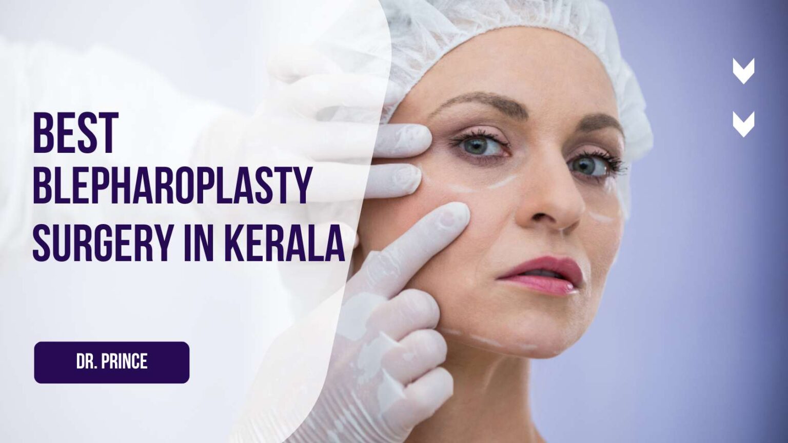 Blepharoplasty Surgery in Kerala - topplasticsurgery