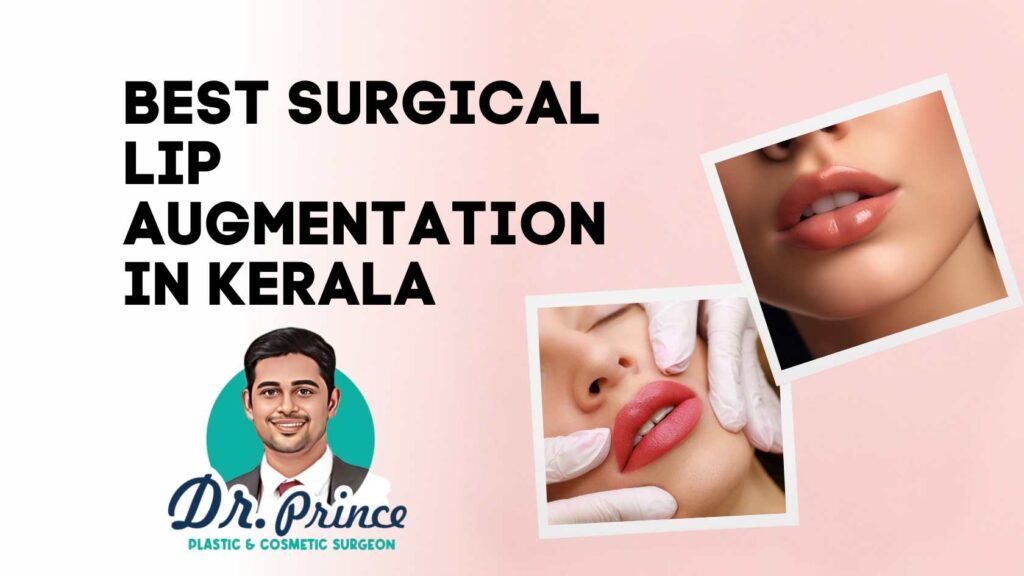 Best Surgical Lip Augmentation in Kerala - topplasticsurgery