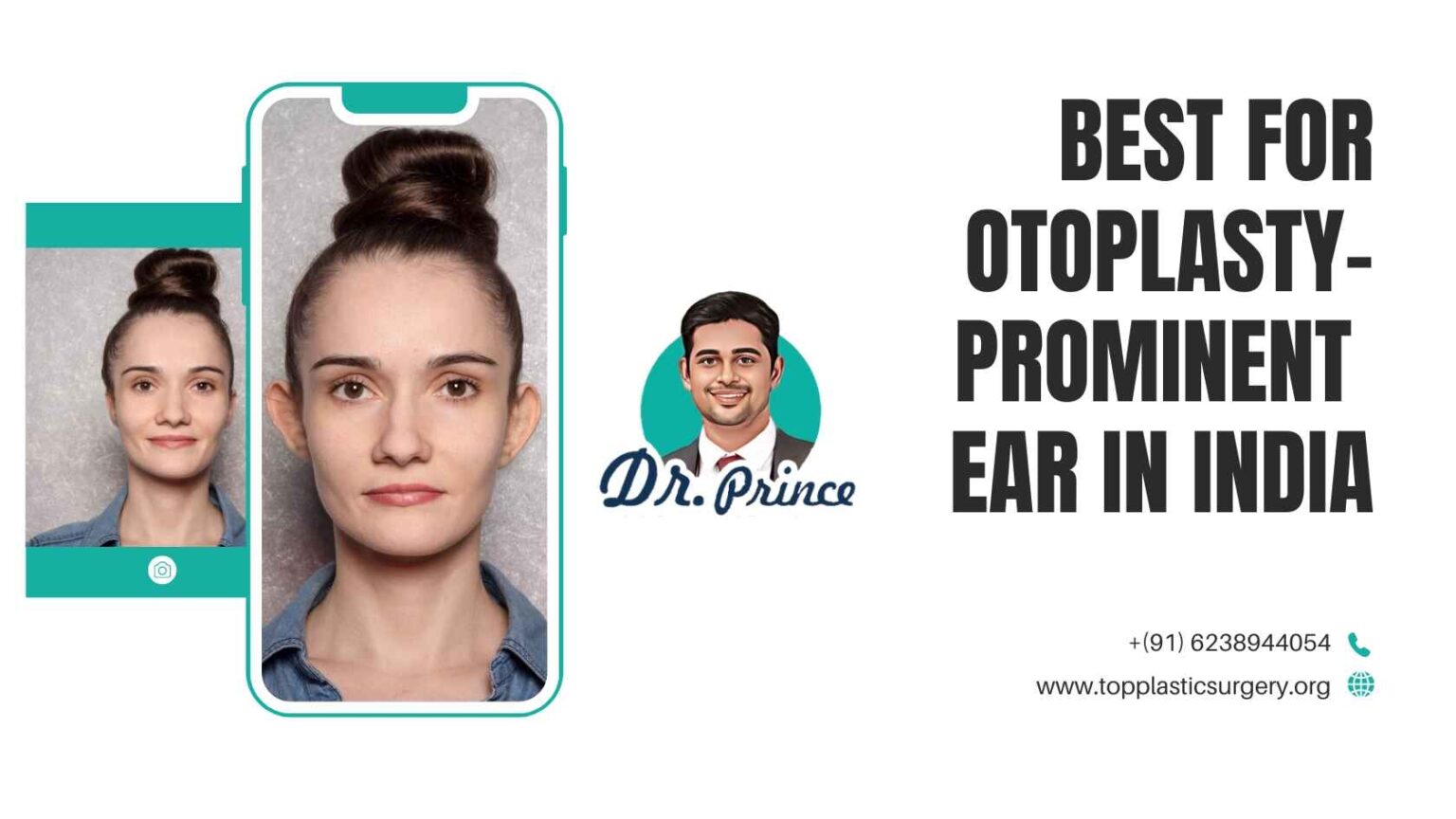 Best for Otoplasty - Prominent Ear in India - topplasticsurgery
