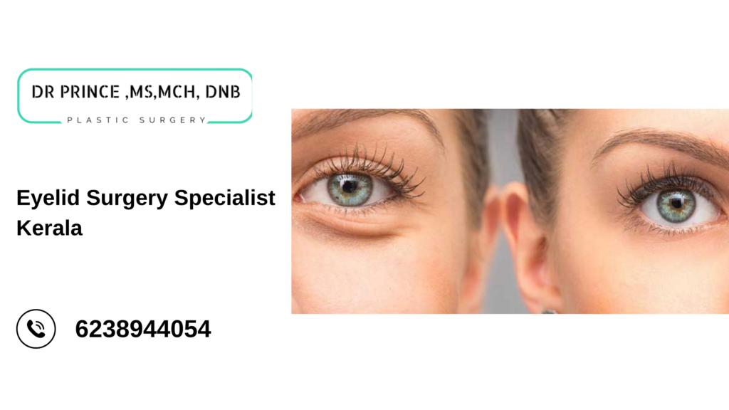Eyelid Surgery Specialist Kerala - topplasticsurgery