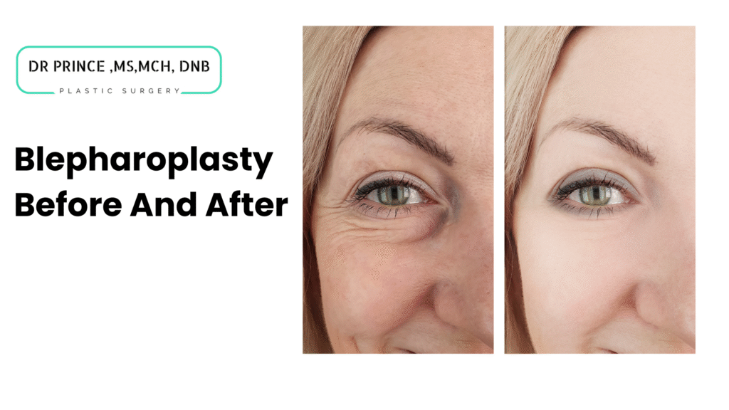 Navigating the Landscape of Multiple Lipomas: Understanding, Management, and Empowerment ...