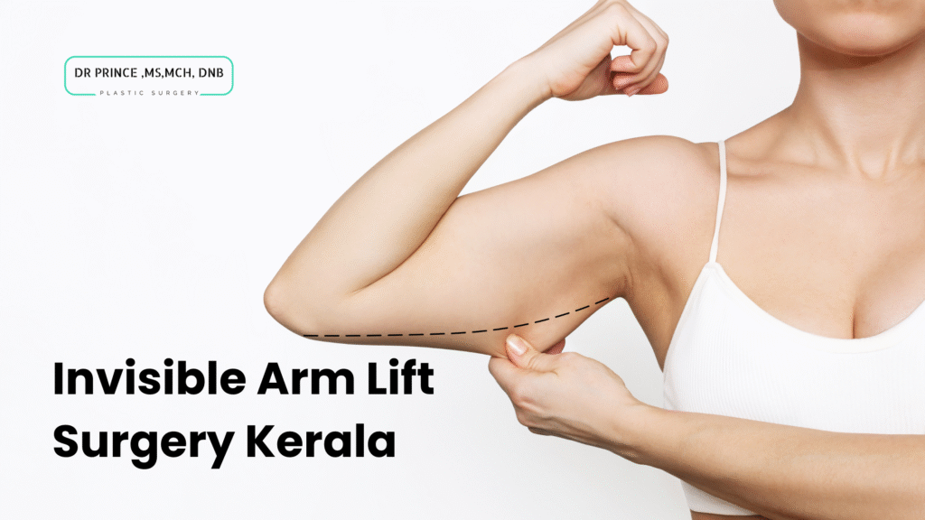 Invisible Arm Lift Surgery Kerala - topplasticsurgery